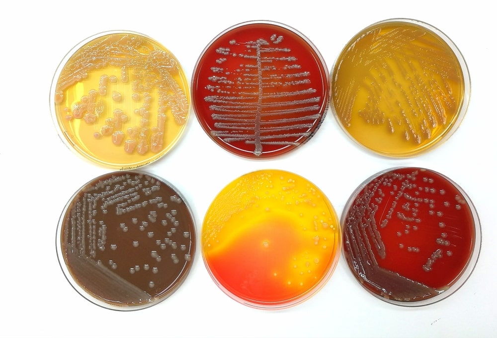 Dehydrated Microbial Culture Media